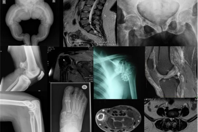 Musculoskeletal Imaging | Department of Diagnostic Imaging & Radiation Medicine